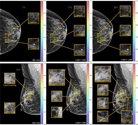 Figure 1 From Multi Scale Convolutional Neural Networks For