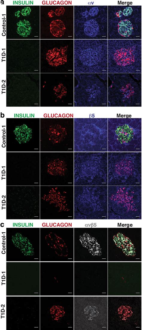 Expression Of The Integrin Heterodimer αvβ5 And Its Component Subunits