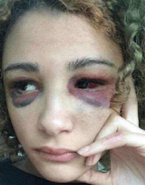 El Crudo Y Estremecedor Relato De La Ex Novia De Xxxtentacion Sobre Las