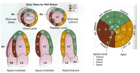 Echo Review Basics Flashcards Quizlet