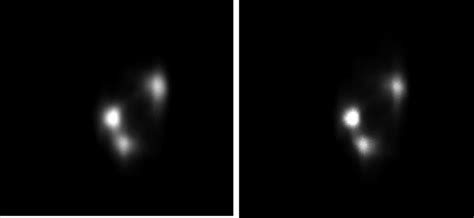 Extracted Oblique Slice Images From Measurement Left And Calculated