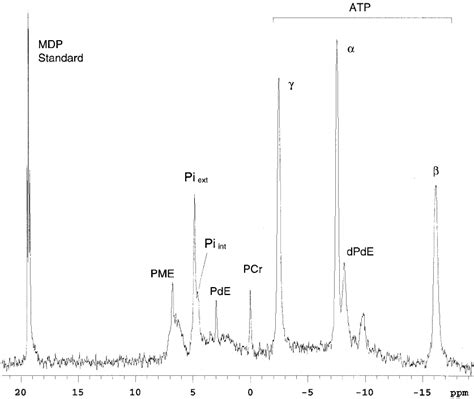P MR Spectrum Acquired Days After Cell Seeding The Spectrum Was Download Scientific