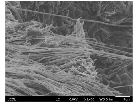 NESPS An Injectable Nanofiber Hydrogel Composite With Interfacial
