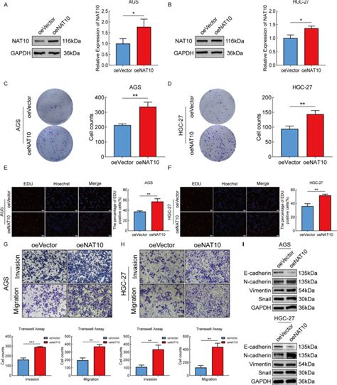 Acetyltransferase Nat10 Promotes Gastric Cancer Progression By Regulating The Wnt β Catenin