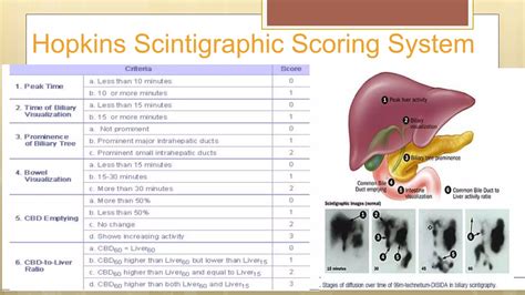 Sods Sphincter Of Oddi Dysfunction Ppt
