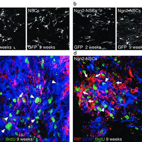 Schematic Illustration Of A Segmental Spinal Cord Circuit Connecting Download Scientific Schematic Illustration Of A Segmental Spinal Cord Circuit Connecting Download Scientific