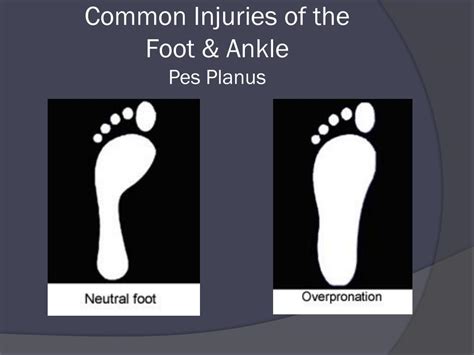 Ppt The Foot Ankle And Lower Leg Injuries Powerpoint Presentation Id