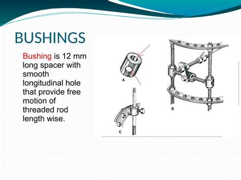 Ilizarov Instrumentation 2 2 Pdf Needlework Arts And Crafts