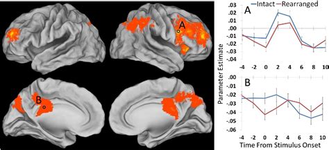 Figure 2 From Pre Stimulus Neural Activity Predicts Successful Encoding
