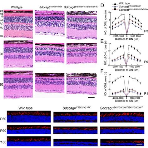 Retinal Morphology Of Rod Cone Photoreceptor Degeneration In Sdccag8 Download Scientific