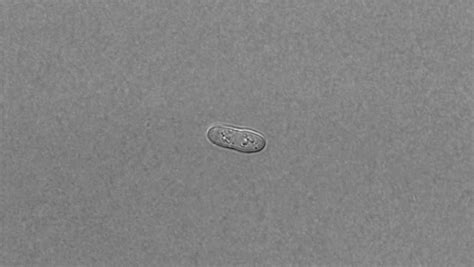 Fission Yeast Schizosaccharomyces Pombe Reproduction Stok Videosu