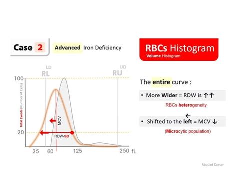 Rbc Histogram Ppt
