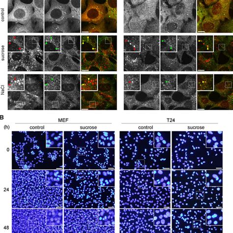 Hyperosmotic Stress Induces Autophagosomal Structures In Mefs And T24