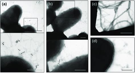 Immunogold Labeling Of Afp And Tem Analysis A Wild Type Upec 46 B Download Scientific