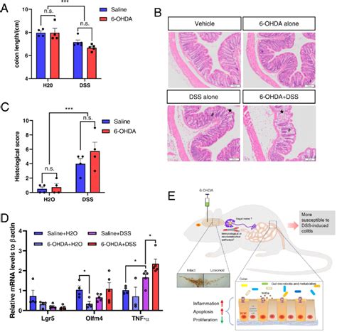 Reduced Resistance Of 6 Ohda Treated Mice To Dss Induced Colitis A
