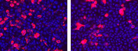 Down Syndrome Cell Adhesion Molecule Dscam Antibody Ds2 176 Medimabs
