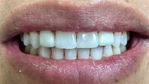 Gallery Horizon Dental Bench Boise Id