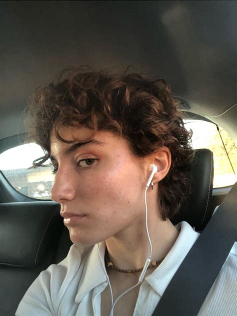 Tretinoin Progress 6 Month Progress Rtretinoin