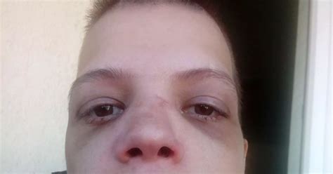 Horrific Injuries Inflicted On Sex Slave Mutilated By Criminals Who