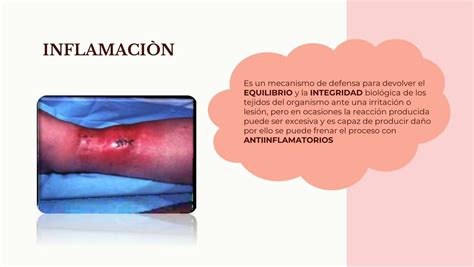 Inflamación Linda Milena León Gómez uDocz
