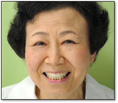美容診療｜大牟田市の歯科・美容診療｜そのだ歯科医院｜アンチエイジング