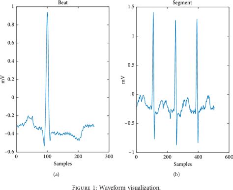 Figure 1 From Automated Detection Of Arrhythmia For Hybrid Neural Network Of Lstm Residual With