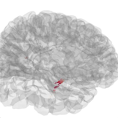 Plotting With Mne Viz Brain MNE 1 1 1 Documentation