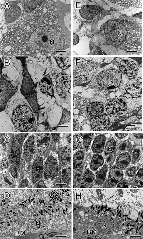 Effect Of Intravitreal Injection Of Tnk On Retinal Ultrastructure