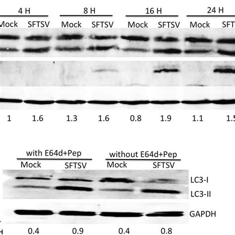 Nss Protein Positive Structures Are Found In The Sftsv Infected Cells Download Scientific