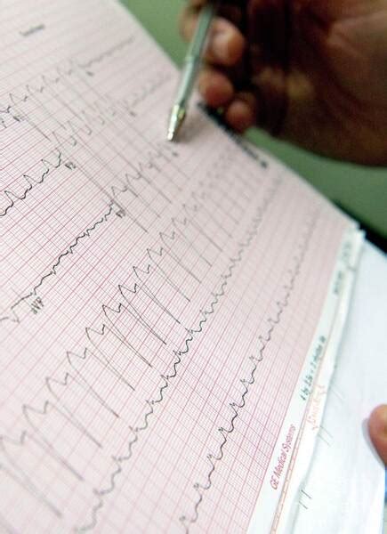 Electrocardiogram Posters By Science Photo Library