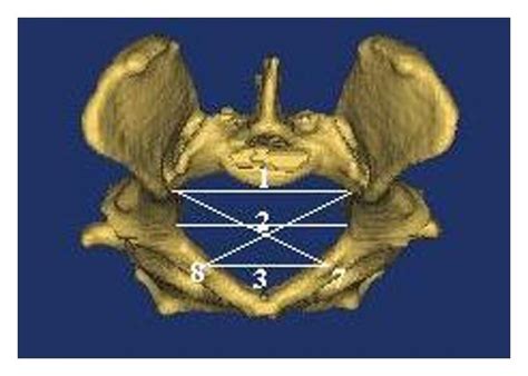 Measurements On Facies Cranialis Of Pelvic Cavity Download Scientific Diagram