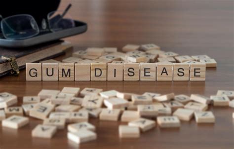 Gum Disease Myths Natick Papageorgiou Dental Associates