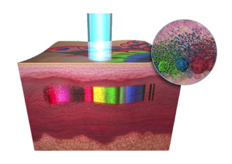 Picosure อีกขั้นของเลเซอร์รักษาฝ้า กระ จุดด่างดำ สีผิวไม่สม่ำเสมอ อย่าง