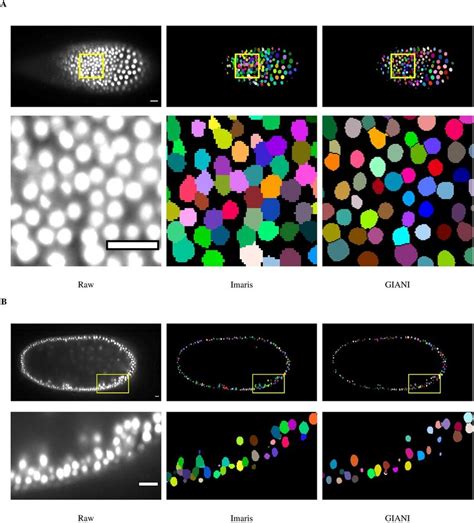 Demonstration Of Giani On A Large Light Sheet Microscopy Dataset