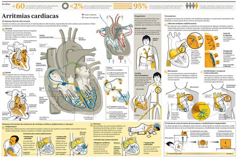 Auricular Contribuyente Sympton Deteccion Fibrilacion Auricular Engaño