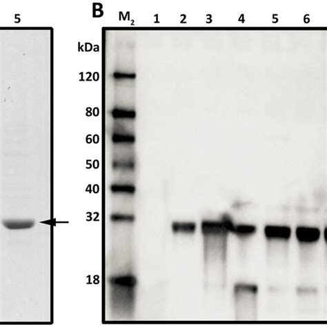 Sds Page Western Blot And Native Page Analysis Of The Expression And