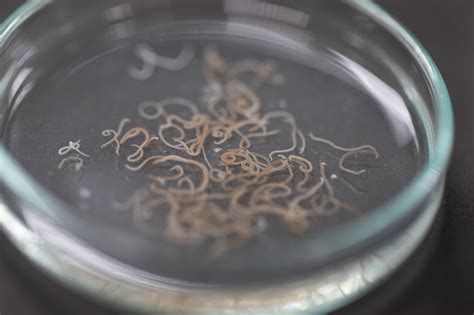Ascariasis Adalah Penyakit Yang Disebabkan Oleh Cacing Gelang Parasit Ascaris Lumbricoides Untuk