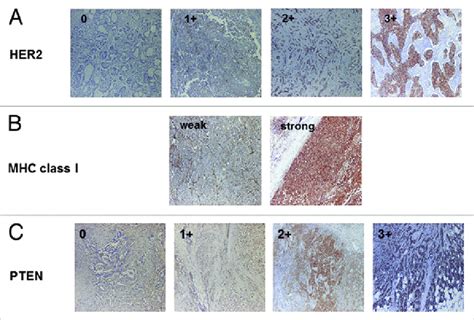 Representative Immunostaining Of Her2 Mhc Class I And Pten A Her2