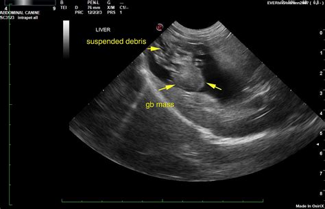 Highly Vascular Gallbladder Mass In A 10 Year Old Mn Bichon Frise Members