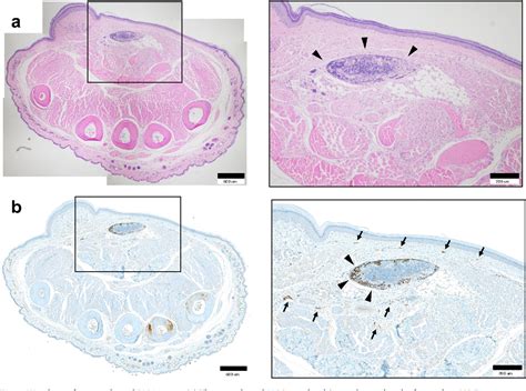 Figure 5 From Lymphangiogenesis After Nonvascularized Lymph Node