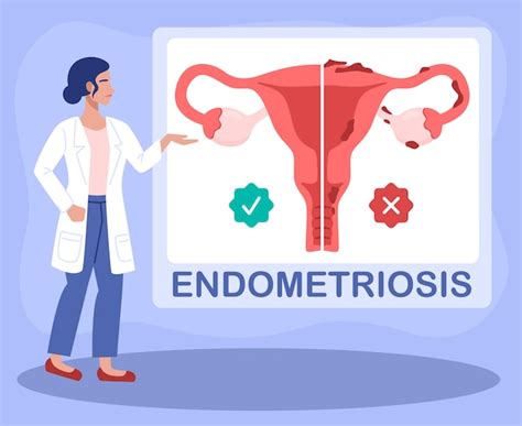 Médico ginecologista fala sobre endometriose útero e saúde da mulher Vetor Premium
