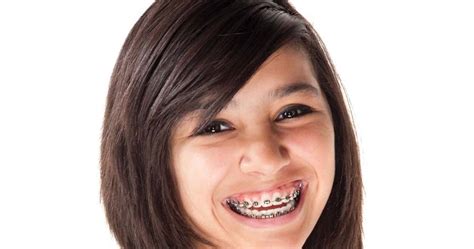 Maple Leaf Times What To Do If Teeth Shift After Braces