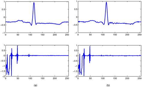 An Original Segment Of Record No100 In The Mit Bih Arrhythmia Database Download Scientific