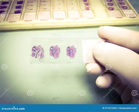 Histology Hematoxylin And Eosin He Stained Glass Slide Royalty Free Stock Image