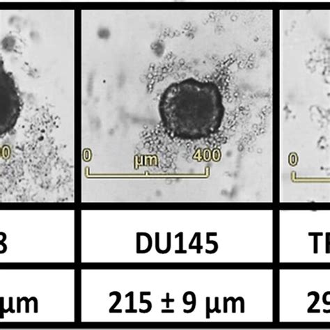 Incucyte® Live‐cell System ×4 Live Spheroids Images Show The