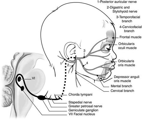 Congenital And Acquired Facial Palsies Clinical Tree