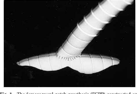 Figure 1 From Femorodistal Ptfe Bypass Grafting For Severe Limb Ischaemia Results Of A