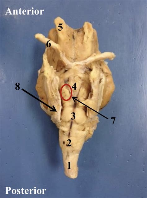 Sheep Brain Inferior View Diagram Quizlet