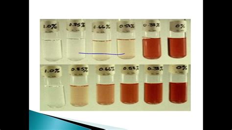 Practical Blood Physiology Lecture 2 Osmotic Fragility Test Youtube