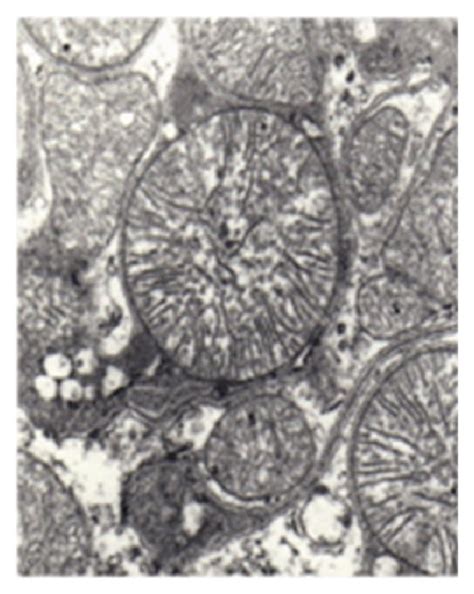 Ultrastructure Of Hepatocytes Of The Different Groups A Control